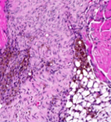 Synthetic Materials Influence Body’s Healing Response | NIH Intramural ...